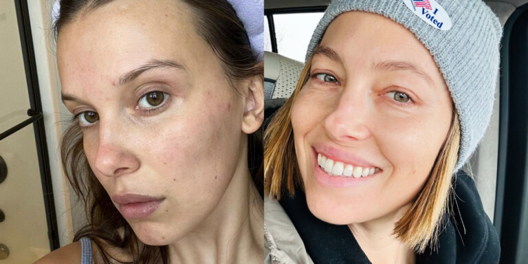 Ces stars qui enflamment l'hiver sans maquillage